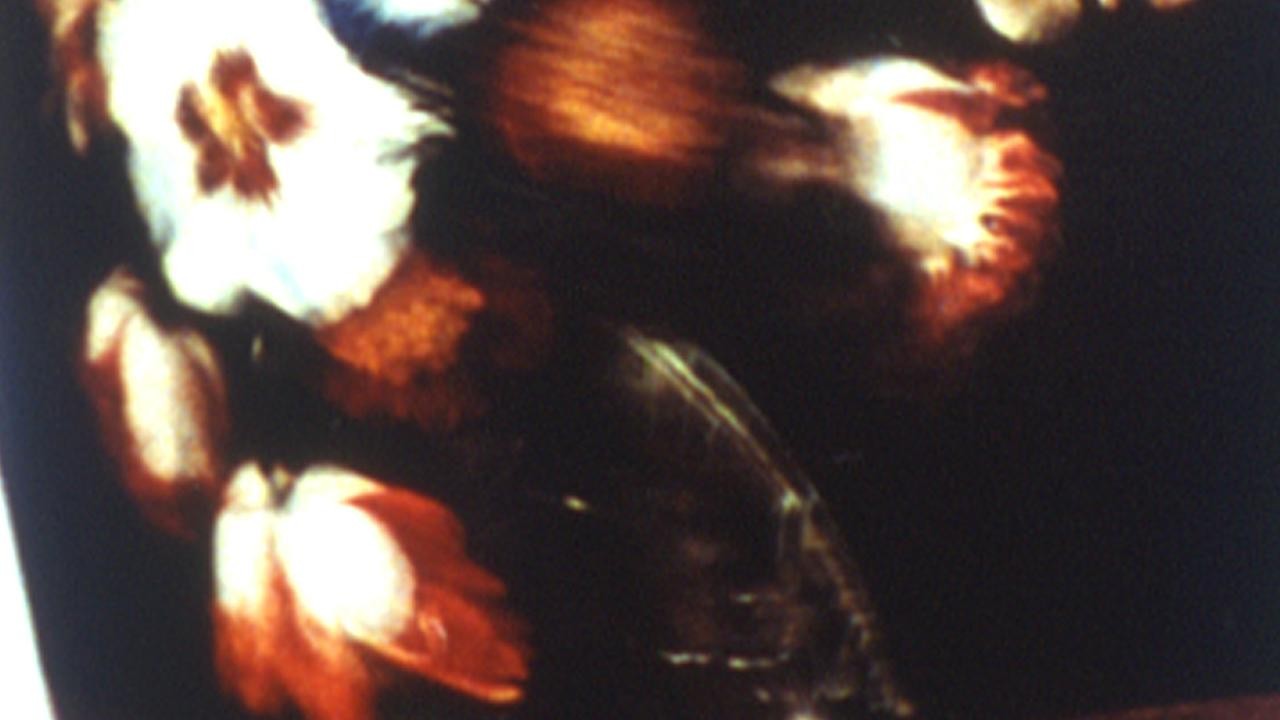 The Parable of the Tulip Painter and the Fly (2008) | MUBI