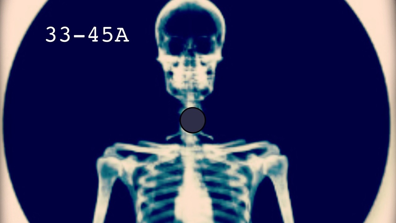 The Bone Records of Leningrad (2025) | MUBI